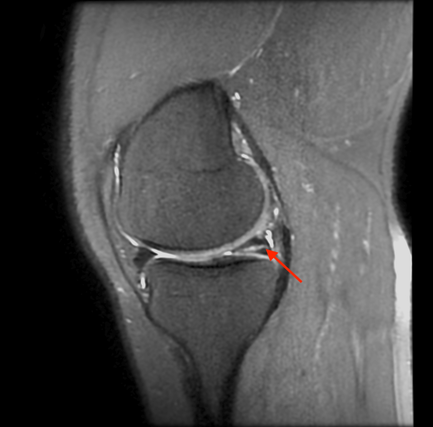 Patientenstory: „Japan, wir kommen!“ – Internationales Zentrum für ...